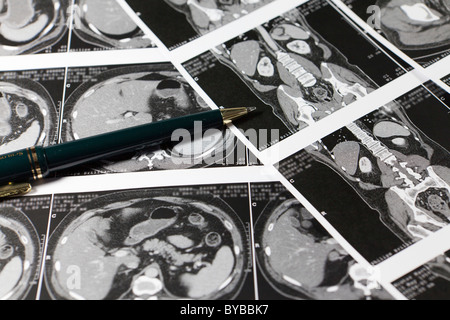 Multi-slice computed tomography, magnetic resonance imaging, MRI ...