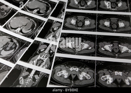 Multi-slice computed tomography, magnetic resonance imaging, MRI ...