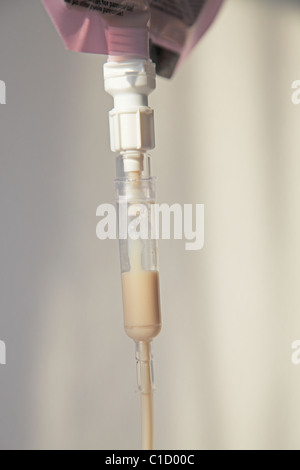 Intensive care unit. Intravenous infusion. Sodium Chloride. Vietnam ...