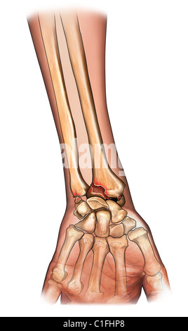 The bones of the wrist Stock Photo - Alamy