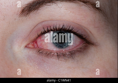 blue eye eyes IRIS CONJUNCTIVA EYELASHES EYELASH PUPIL EYEBALL TEAR ...