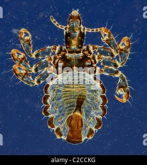 The pig louse Haematopinus suis, photomicrograph Stock Photo - Alamy