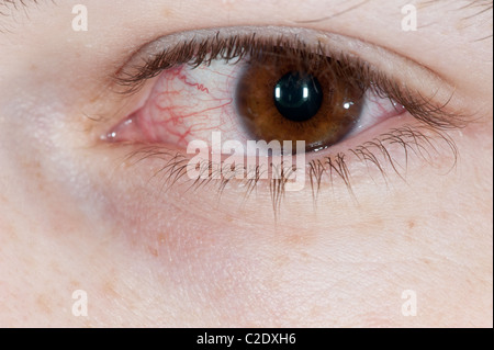 blue eye eyes IRIS CONJUNCTIVA EYELASHES EYELASH PUPIL EYEBALL TEAR ...