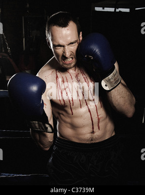 Boxer man, fight and blood of a boxing fighter with cigarette after ...