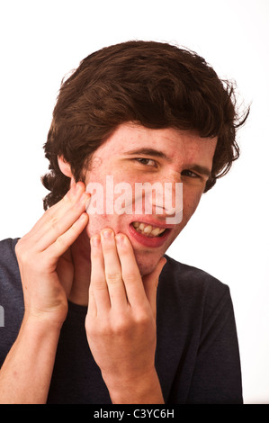 a spotty faced young man teenager youth with acne bad skin complexion ...