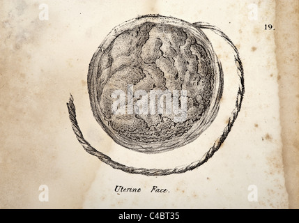 Illustration of the human placenta. The placenta is an organ that ...