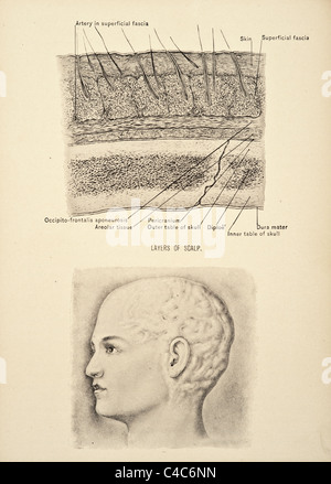 Illustration of Human Superficial Fascia of the Scalp copyright 1904 ...