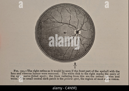 Antique medical illustration of eye disease and Ophthalmologic surgery ...