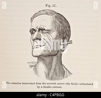 Facial Muscles, illustration Stock Photo - Alamy