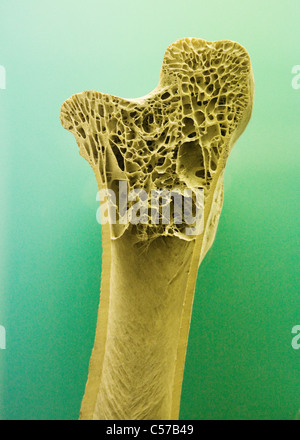 Cross section view of a human femur bone showing trabecula Stock Photo ...