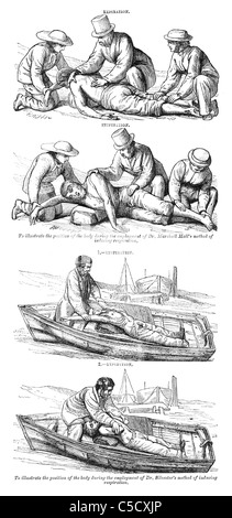 Old methods for treatment of the apparently drowned. Illustration from ...