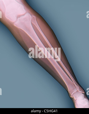 Normal lower legs, X-ray Stock Photo - Alamy