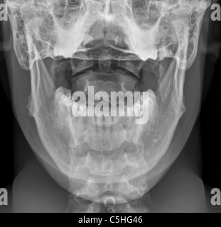 Normal neck, X-ray Stock Photo - Alamy