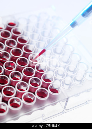 sample of bloods Stock Photo - Alamy