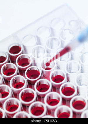 sample of bloods Stock Photo - Alamy