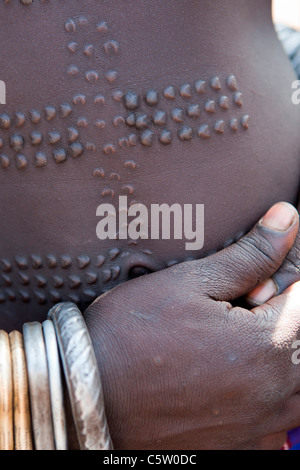 Detail of scarification used by Mursi tribeswomen in the Lower Omo ...