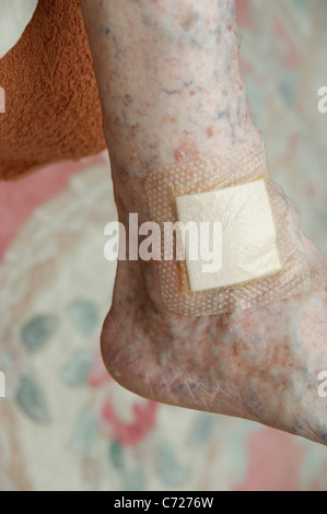 Elderly woman with Mepilex borderlite iodine dressing / plaster to keep ...
