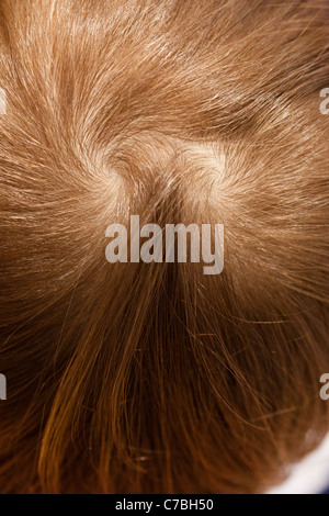 Young boy with double crown / cowlick / whorl Stock Photo - Alamy