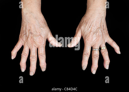 Closeup shot of open palms of old woman Stock Photo - Alamy