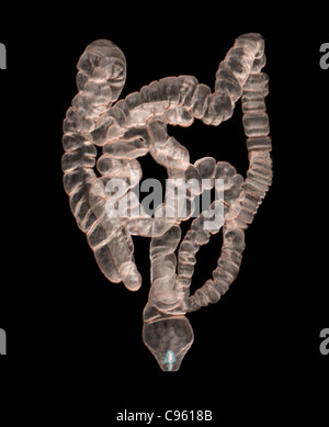 Normal intestines. Coloured 3D computed tomography (CT) scan of the ...