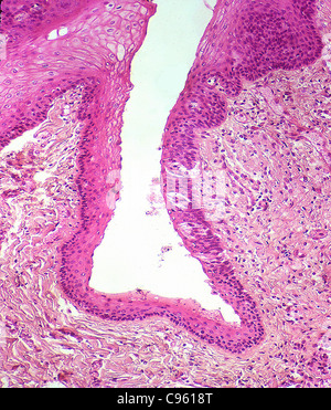 Taste buds Light micrograph of a section through a tongue showing a ...
