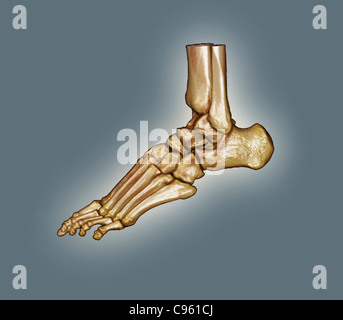 Normal foot. Coloured 3D computed tomography (CT) scan of the healthy ...