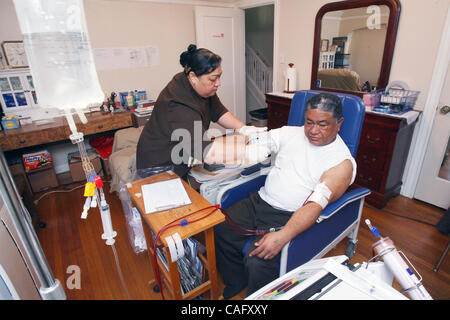 Saia Faasisila hook up his portable dialysis machine in his San Mateo ...