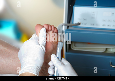 A podiatrist edit the toenails with a grinding machine Stock Photo - Alamy