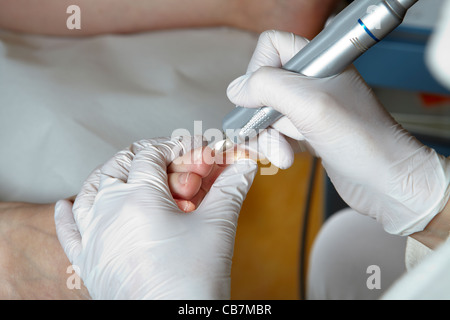 A podiatrist edit the toenails with a grinding machine Stock Photo - Alamy