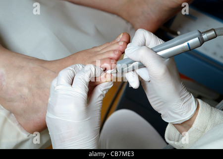 A podiatrist edit the toenails with a grinding machine Stock Photo - Alamy