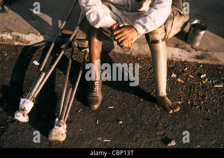 An amputee man with a prosthesis called "Jaipur foot" ( India Stock ...