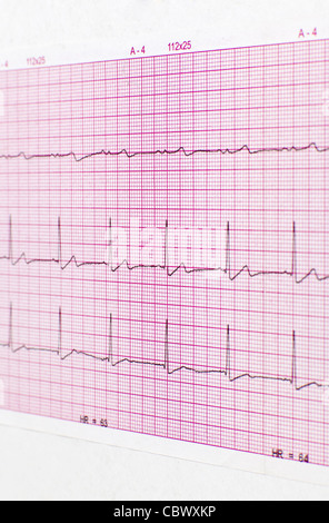 ECG printout isolated on white background Stock Photo - Alamy