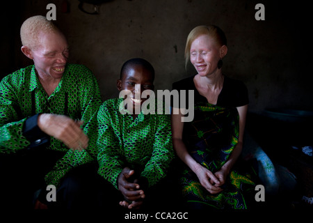 albinos couple in Tanzania Stock Photo - Alamy