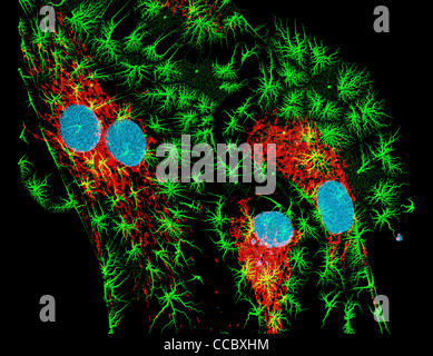 Fibroblast cell. Confocal light micrograph of a mammalian fibroblast ...