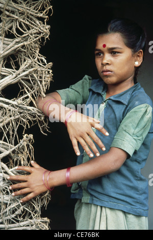 Hexadactyly ; Indian girl with six fingers in hands ; congenital ...