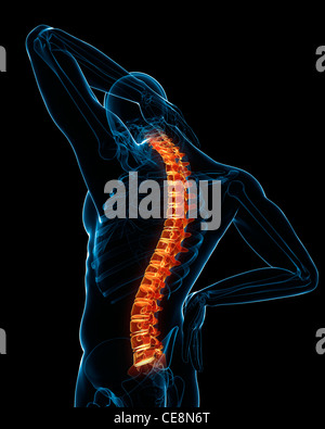 Human back pain, computer artwork Stock Photo - Alamy