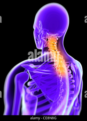 Human back pain, computer artwork Stock Photo - Alamy
