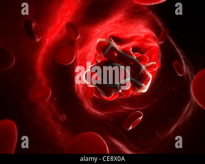 Blood clot, drawing Stock Photo - Alamy