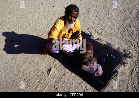 An Indian man suffering from Elephantiasis has a bloated leg. He Stock ...