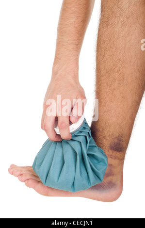 Leg Injury. Icing Ankle With Cold Pack And Ice Stock Photo - Alamy