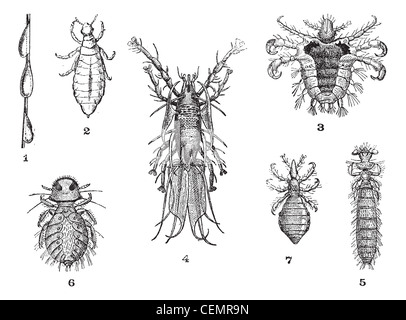 Pubic louse, artwork Stock Photo - Alamy