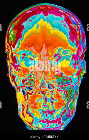 thermogram of some persons Stock Photo - Alamy
