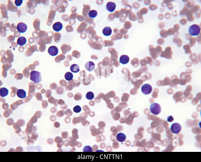 Lymphocyte white blood cells in a blood smear, computer illustration ...