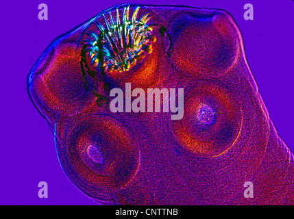 Taenia solium, pork tapeworm Stock Photo - Alamy