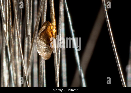 Nits. View of nits (head louse eggs) in human hair. The nits are the ...