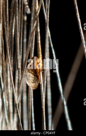 Nits. View of nits (head louse eggs) in human hair. The nits are the ...