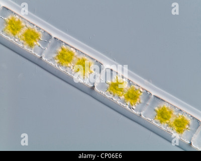 Microscopic view of freshwater algae filament at propagation stage ...
