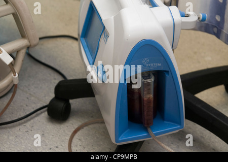 Vacuum Assisted Closure (VAC) or Negative-pressure wound therapy (NPWT ...