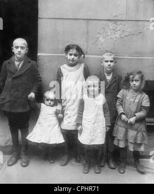 Children With Rickets Stock Photo - Alamy