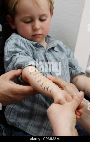 ALLERGY TEST, CHILD Stock Photo - Alamy